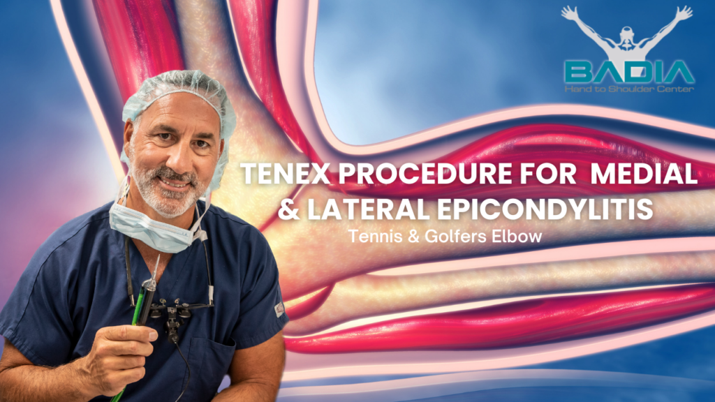 Tenex: Solution for Tennis Elbow - DrBadia.com