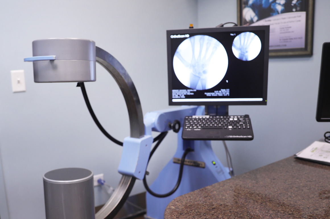 Live Fluoroscopy for Upper Limb Orthopedic Concerns in Miami