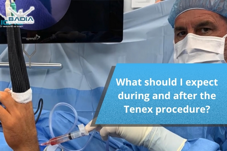 What should I expect during and after the Tenex procedure? - DrBadia.com
